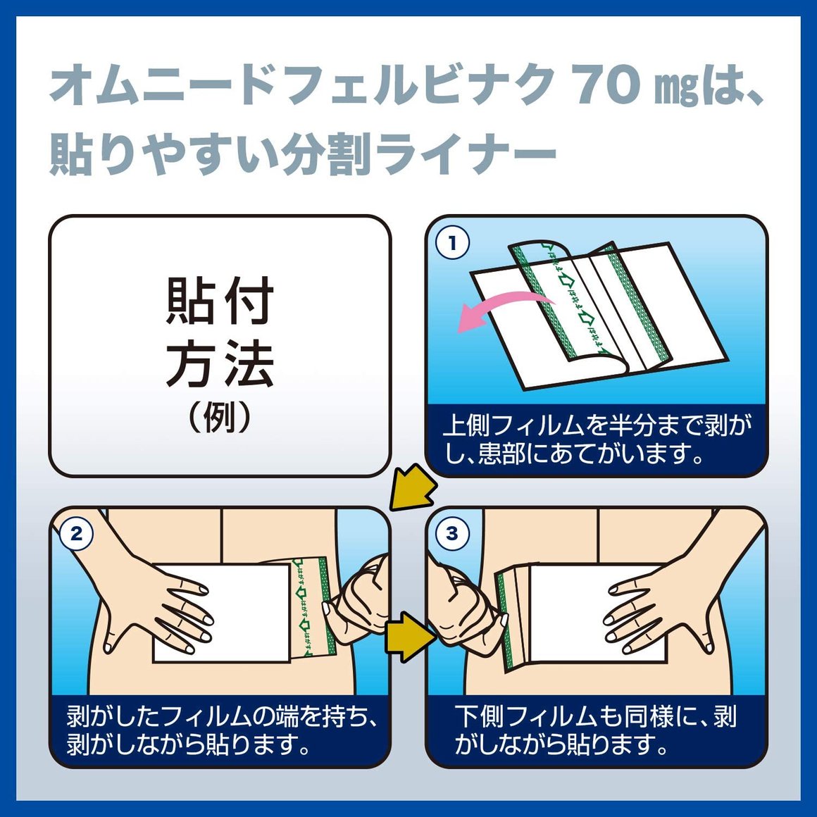 TEIKOKU PHARMACARE An analgesic / anti-inflammatory felbinac pap agent ...